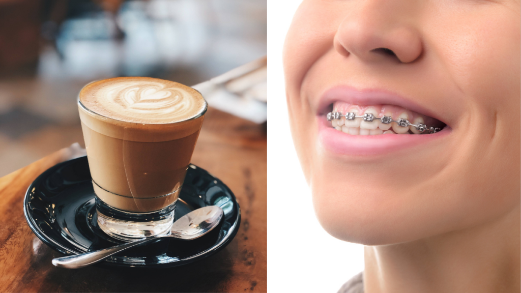 Can You Drink Coffee With Braces? Here's How! - Hero Coffee